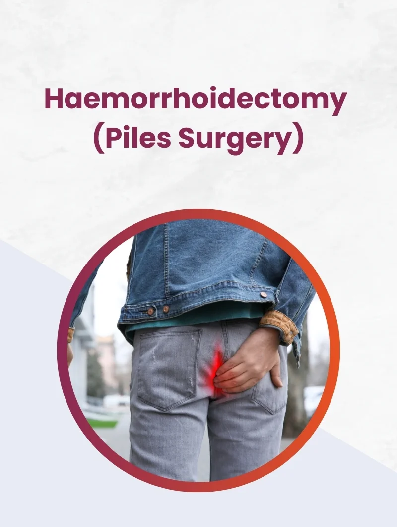 Best Piles Laser Surgery (Haemorrhoidectomy) Surgeons in Gurgaon.