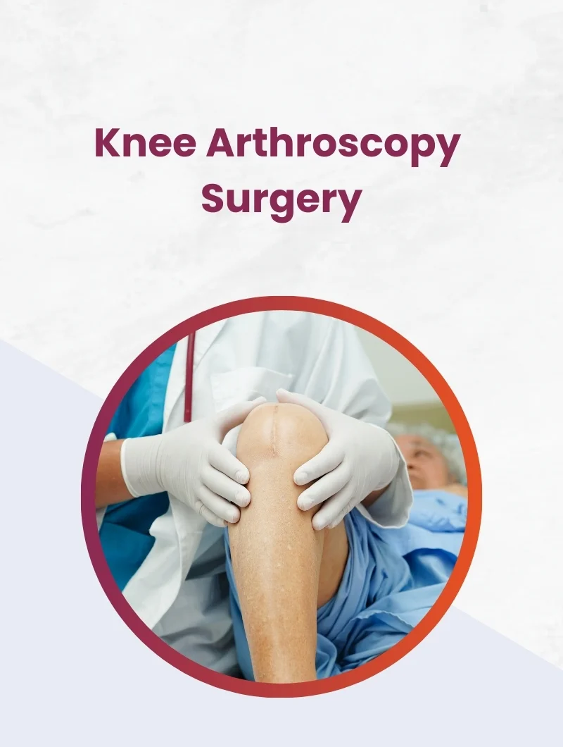 Knee Arthroscopy Surgery Surgeon in Gurgaon