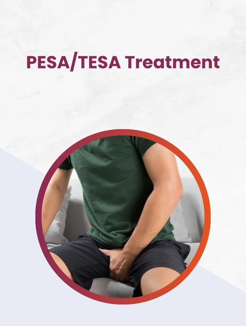 Treatments for Male Infertility: PESA, TESA