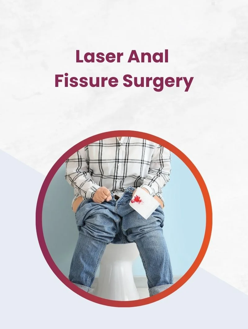 Laser Anal Fissure Surgery Doctor in Gurgaon