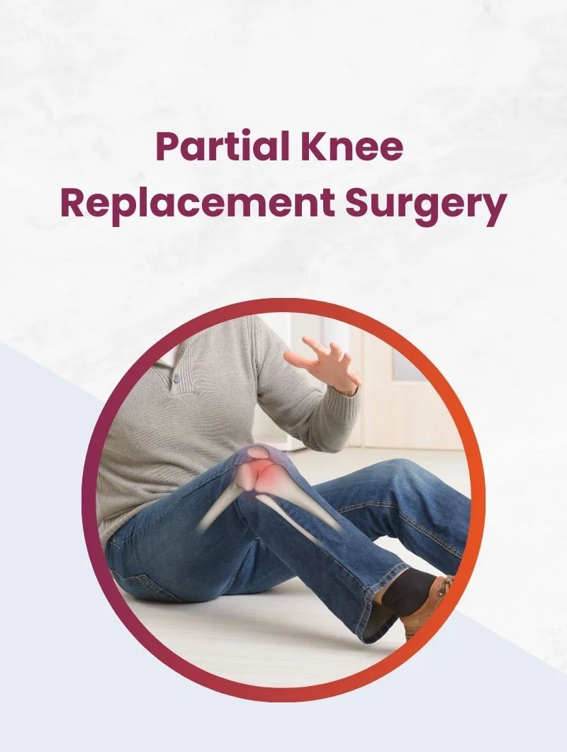 Partial Knee Replacement Surgery: How It is Done?