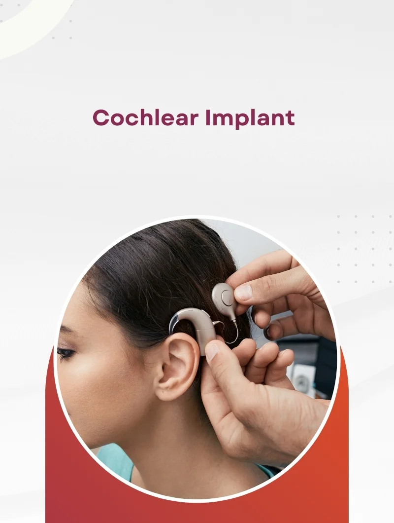 Cochlear Implant Surgery Doctor in Gurgaon
