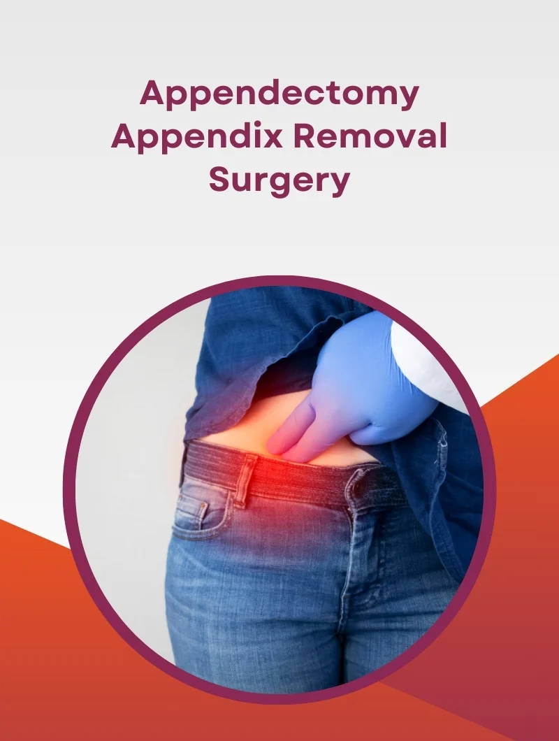 Appendectomy (Appendicitis Surgery) Doctor in Gurgaon