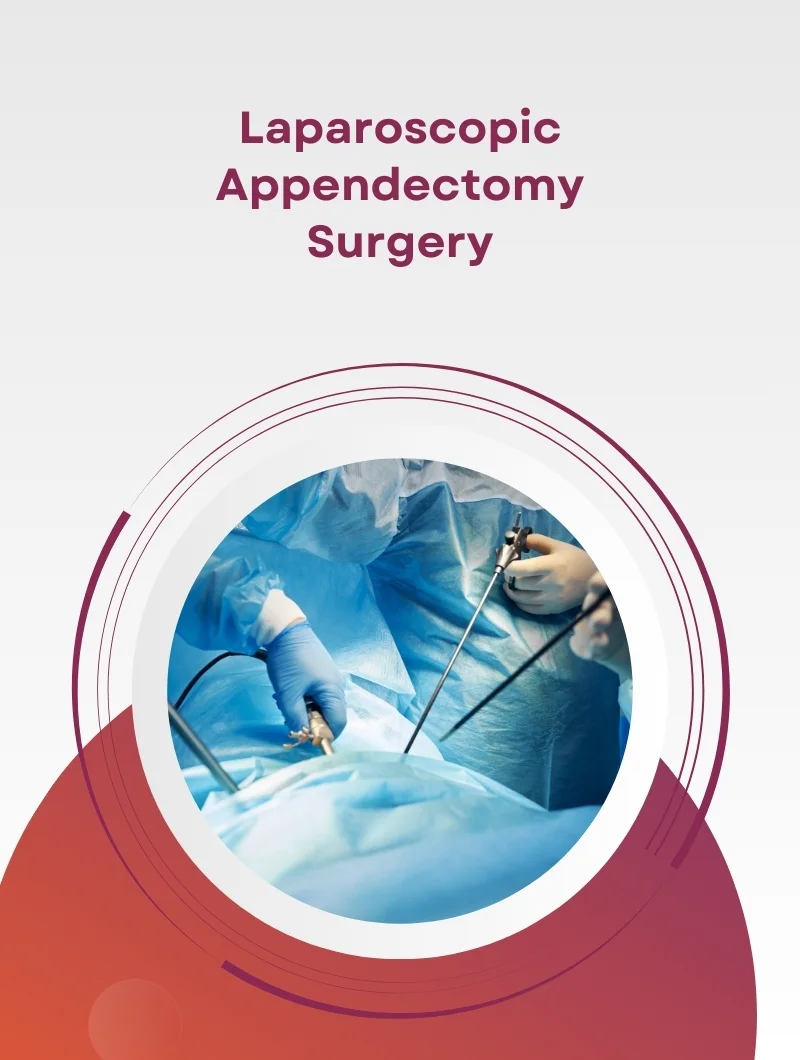 Laparoscopic Appendectomy Surgery Doctor in Gurgaon