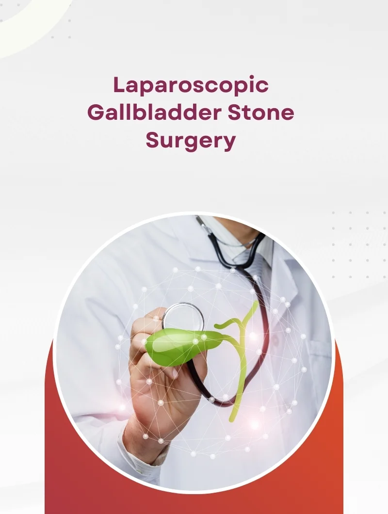 Laparoscopic Gallbladder Stone Surgery Doctor in Gurgaon.