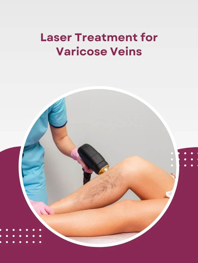 Laser Varicose Veins Treatment Doctor in Gurgaon.