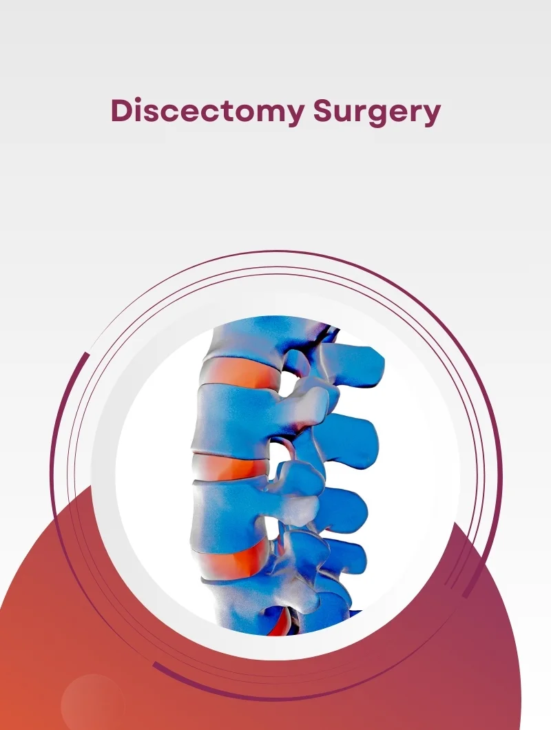 Discectomy Surgery Surgeon in Gurgaon