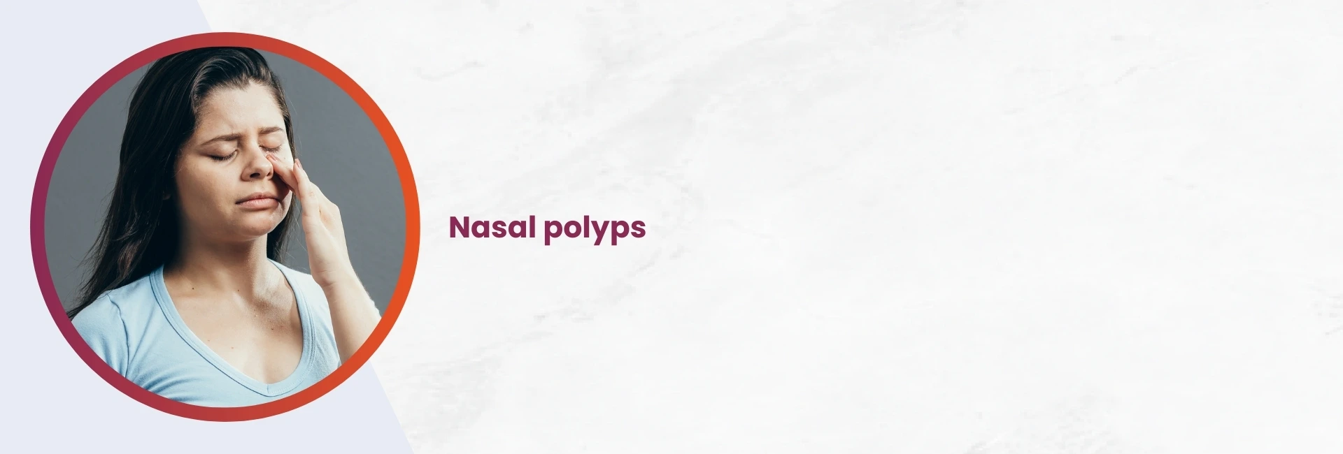 Nasal polyps: Causes, Symptoms, Diagnosis & Treatment