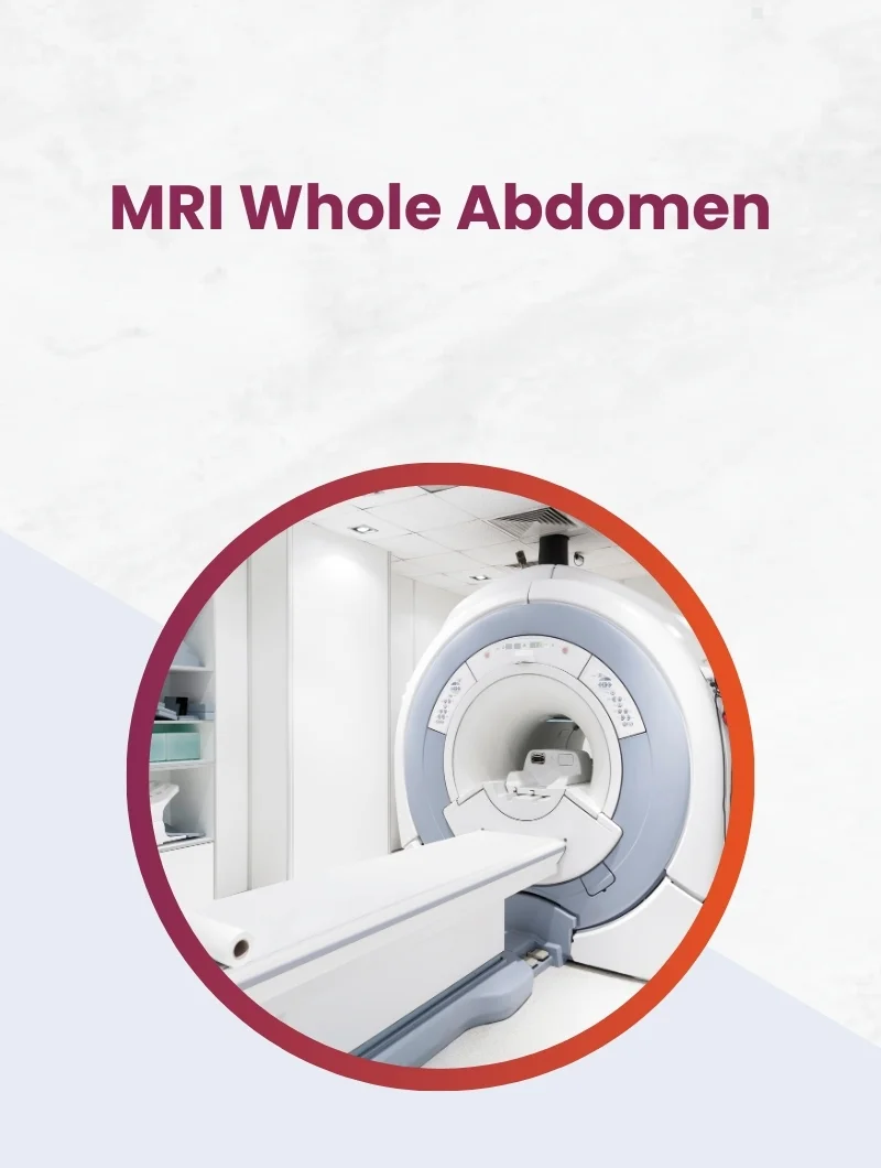 MRI of whole abdomen in Gurgaon